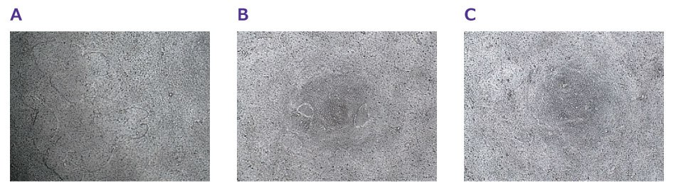 Culturing Colon Organoid Monolayers using Millicell® Hanging Inserts