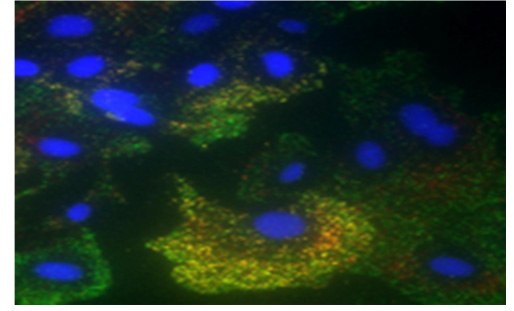 Duolink® PLA Multicolor Detection Protocol