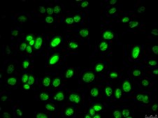 PyMT-1099 Mouse Mammary Tumor EMT Model Cell Line Sigma-Aldrich