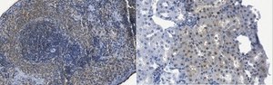 Anti-O-GlcNAc Antibody, clone RL1 clone RL1, from mouse | Sigma-Aldrich
