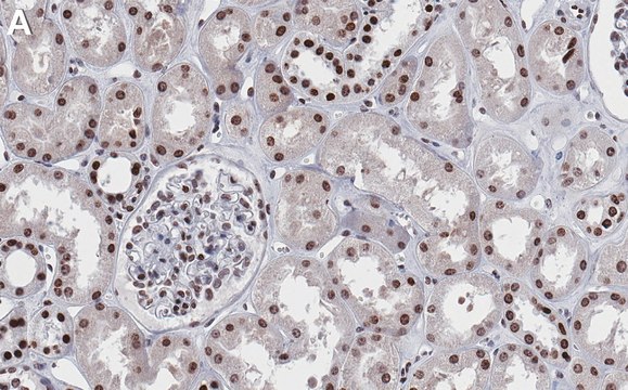 Anti-XIAP Antibody, clone 3H4 ZooMAb® Rabbit Monoclonal recombinant ...