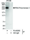 Goat anti-RNA Polymerase II Antibody, Affinity Purified Powered by ...